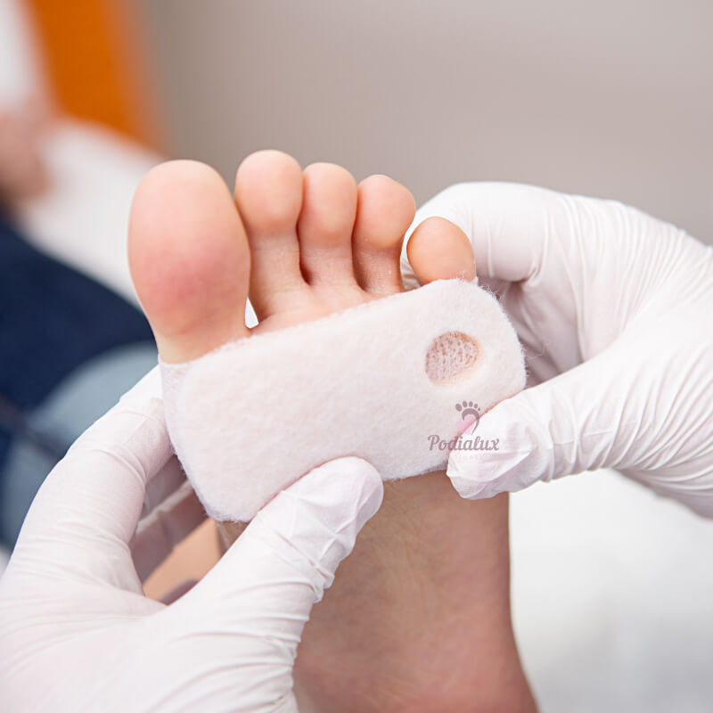 Continuing education for medical pedicure Nalinnes Belgium
